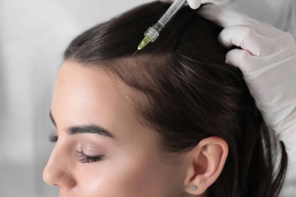 Scalp PRP Treatment in Cranston, RI | Viva Medspa